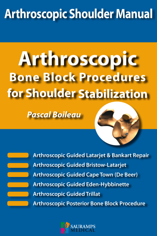SHOULDER CONCEPTS BON BLOCK PROCEDURES FOR SHOULDER STABILIZATION ...