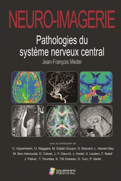 NEURO-IMAGERIE. PATHOLOGIES DU SYSTEME NERVEUX CENTRAL 2ED (Relié) au ...